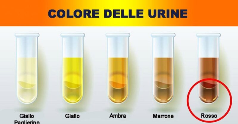 Colore della pipì, disidratazione e salute: cosa sapere Colore della pipì, disidratazione e salute: cosa sapere
