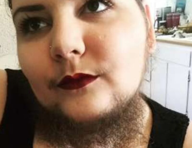 Dakota Cooke Has Won Her Battle The Woman With The Beard Depopulated On Tik Tok Curler