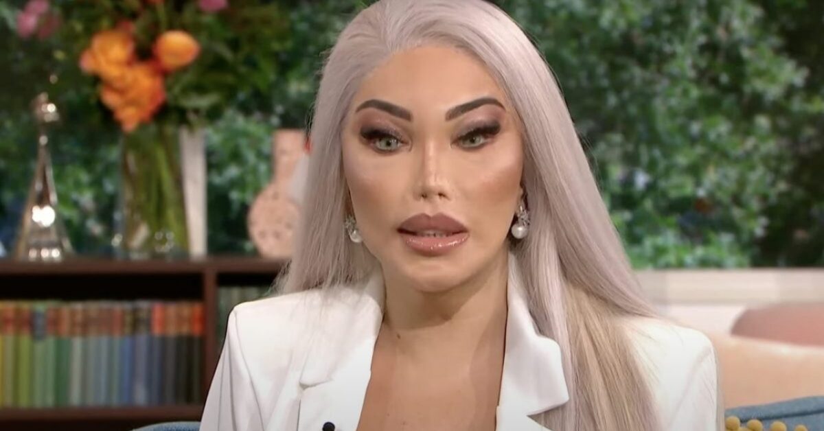 Jessica Alves After 90 Operations She Became Barbie Im 95 Happy